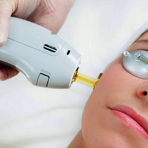 Q-Switch Laser - Cosmetic Laser & Skin Clinic